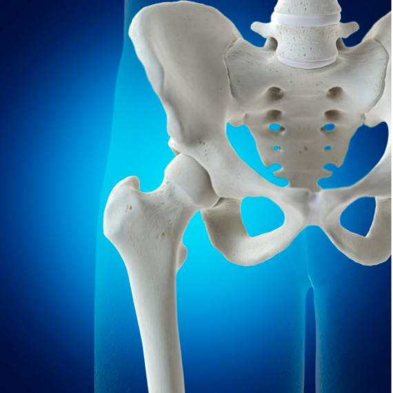Slipped Upper Femoral Epipthysis (SUFE) - Western Paediatric Physiotherapy